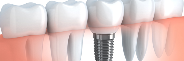 Prosthodontic Services at Mount Elizabeth Medical Centre, Singapore