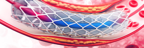Coronary Stent Implantation at Mount Elizabeth Medical Centre, Singapore